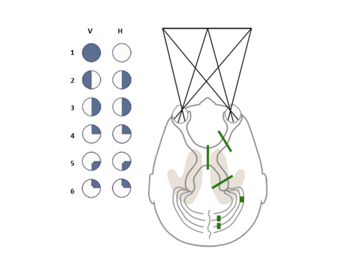 Hemianopsi | Neurorehabilitering – Kbh
