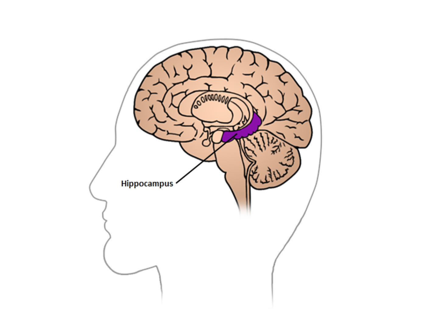 Retrograd amnesi | Neurorehabilitering – Kbh