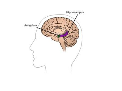 Amnesi | Neurorehabilitering – Kbh