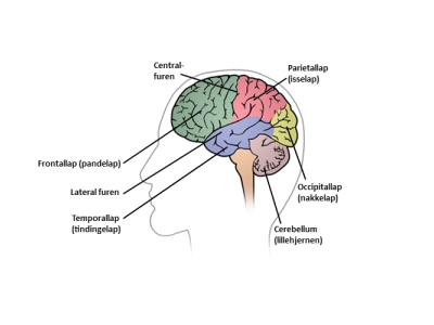 Frontotemporal demens | Neurorehabilitering – Kbh